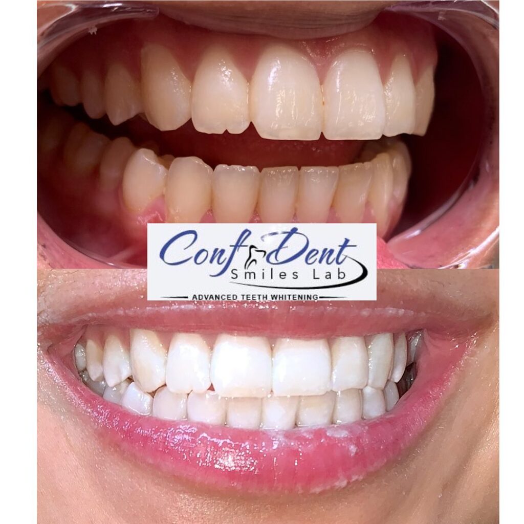 Confident Smiles Lab - DMD - Downtown El Paso